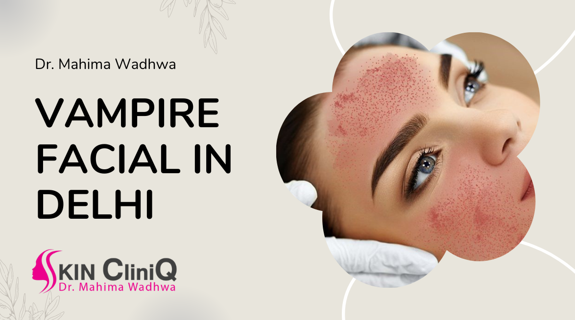 Top Vampire Facial in Delhi - Dr Mahima Wadhwa skin CliniQ